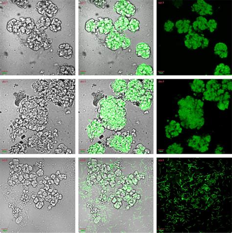 Fluorescence Microscopy Of The Methanogenic Microbial Communities Download Scientific Diagram