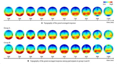 Topography Of The Grand Averaged Eeg Response At Different Time