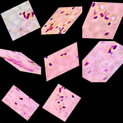 Augmentation Scale And Rotate Download Scientific Diagram