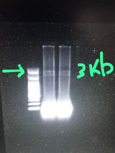 Pgem Vector In Agarose Gel What Is This Researchgate