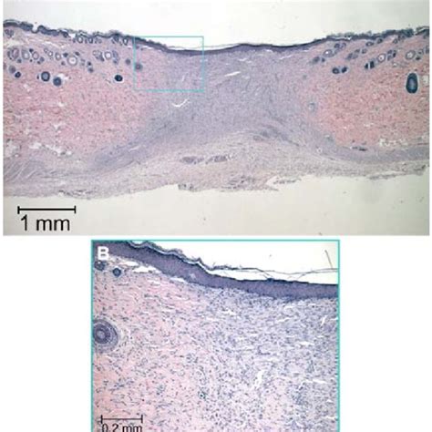 Histological Sections HE Staining 6 Weeks After Surgery A And B Download Scientific