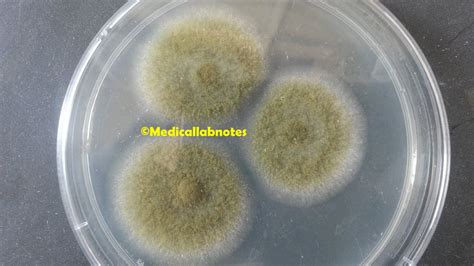 Aspergillus Fumigatus Introduction Morphology Pathogenicity Lab