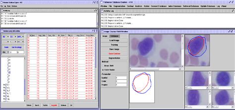 Figure 3 From Unsupervised Segmentation Based On Robust Estimation And