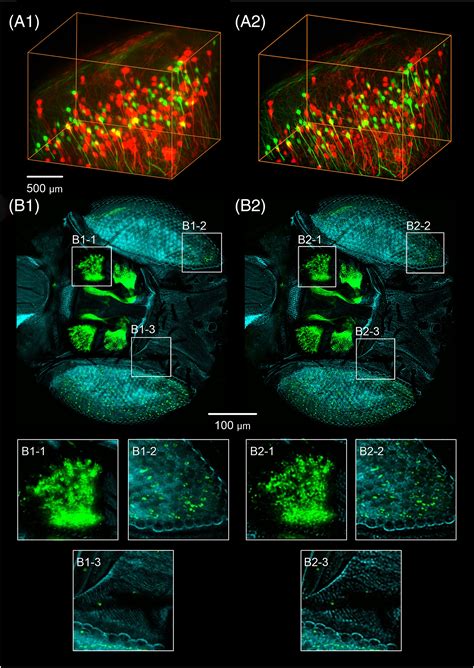 Visualizing Minute Details In Light‐sheet And Confocal Microscopy Data