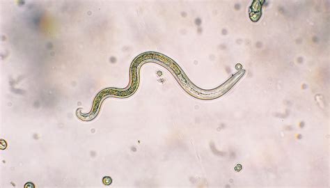 Examples Of Nematodes Sciencing