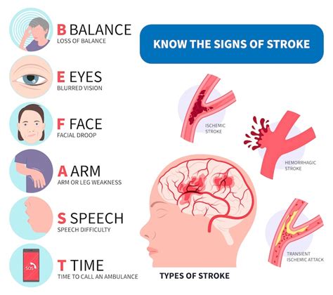 Paediatric Stroke Rehabilitation Treatment And Awareness Napa