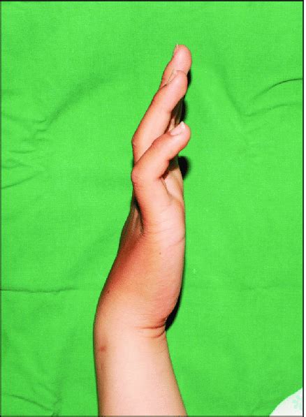 Claw Hand Ludaerotic