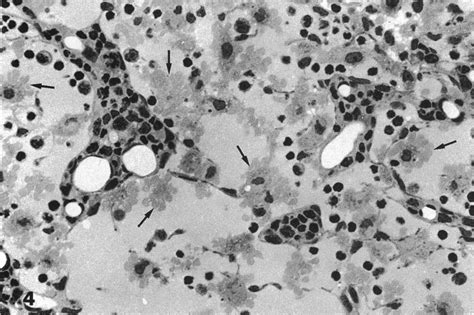 The Subcapsular Sinus Ss Is Wide At The Site Of Entry Of The Afferent