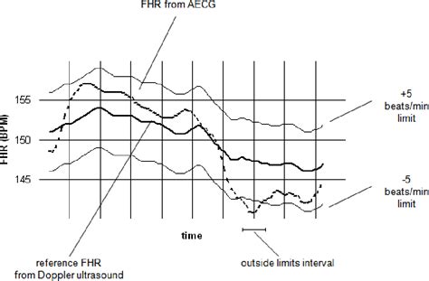 Figure 5 From Biomedical Signal Processing And Applications Semantic