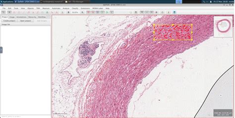 Step 2 Setting Up The Qupath Viewer Nvidia Docs