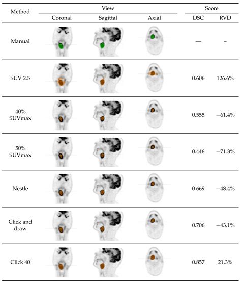 Performance Analysis Of Six Semi Automated Tumour Delineation Methods On 18f