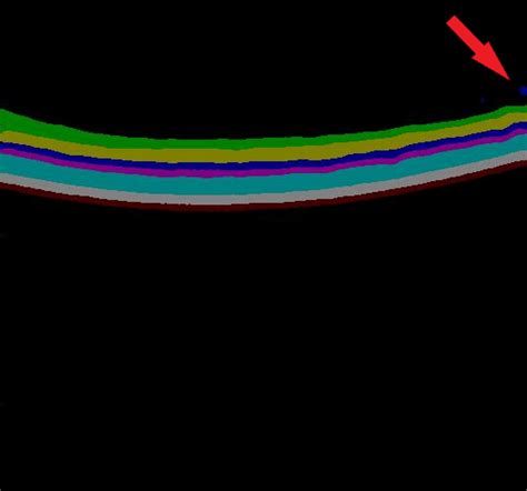 Layer Segmentation Comparison Of A Test Oct B Scan A A Test Oct