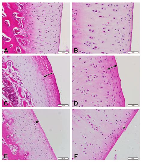 Photomicrographs Of The Proximal Epiphysis Of Tibia Stained With Hand Download Scientific Diagram