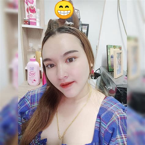 ความผิดปกติของโครโมโซมเพศ มีโรคอะไรบ้าง อาการเป็นอย่างไร