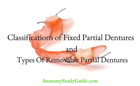 Classifications Of Fixed Partial Dentures And Types Of Removable Partial Dentures Anatomy