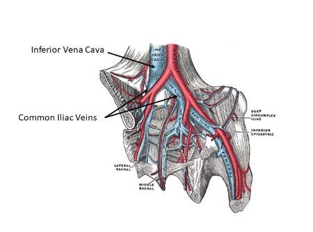 The Common Iliac Veins Come Together To Form A Aorta B Superior