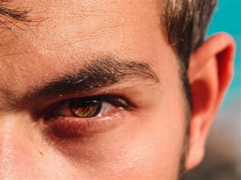 Eyebrow Dandruff Where It Came From And How To Deal With It Chic Lash