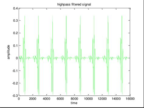 the high pass filtered ecg signal download scientific diagram