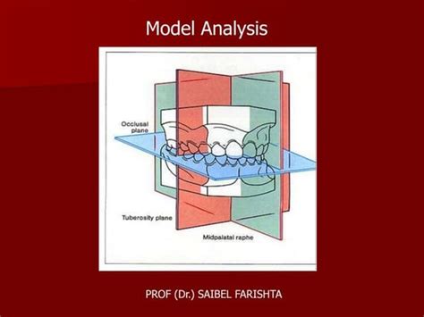 Model Analysispptx