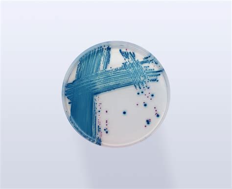 Chromagar™ Stec Plastlabor