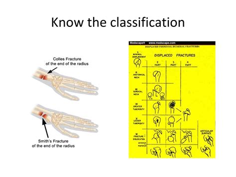 Ortho 03 Principle Of Closed Reduction In Fracture And Dislocation Ppt
