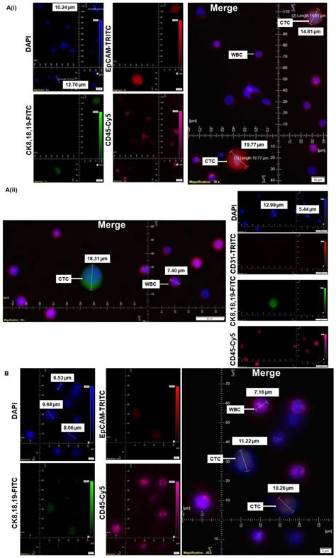 Standardization And Validation Of Ctc By If×3 Using Breast Ovarian Download Scientific