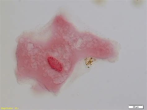 Difference Between Ectoplasm And Endoplasm Compare The Difference Between Similar Terms