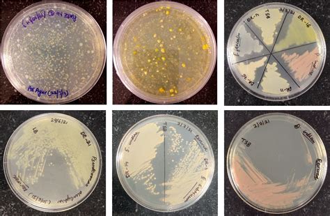 Isolation Propagation And Identification Of Bacterial Species With Hydrocarbon Metabolizing