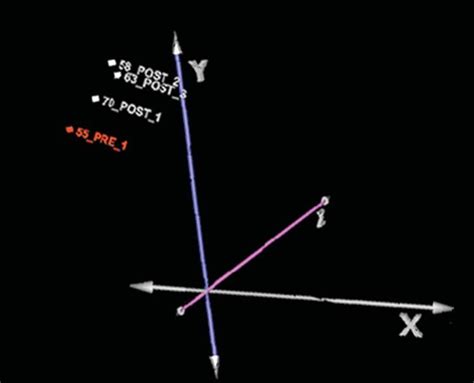 Principal Component Analysis Principal Component Analysis Showing In Download Scientific