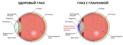 Где Находится Хрусталик В Глазу Фото — Фото
