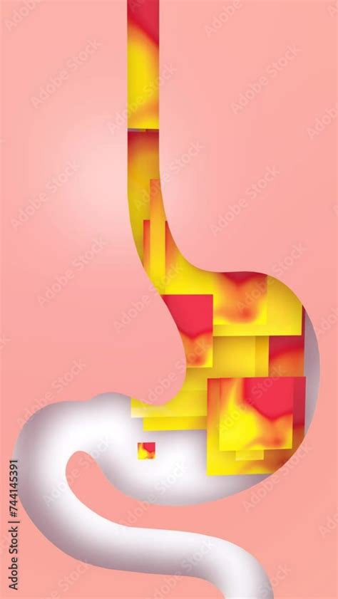 Vidéo Stock 3d Animation Of Stomach With Rectangles Of Fire Inside