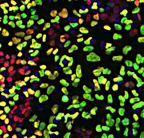 Mitochondria Trigger Cell Aging Response