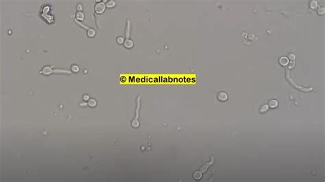 Candida Introduction Morphology Pathogenicity Lab Diagnosis