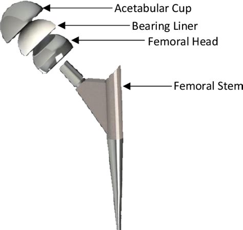 Figure 1 From Computational Method For Bearing Surface Wear Prediction