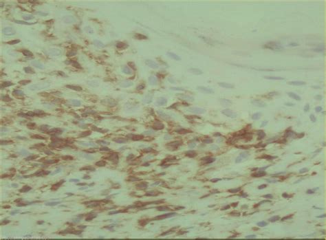 Global Skin Path Atlas Diagnosis Detail