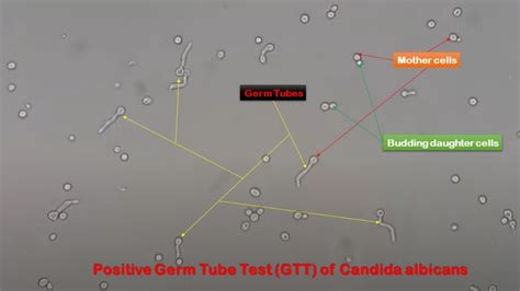 Germ Tube Test Introduction Principle Procedure Result Interpretation