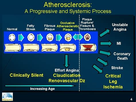 Peripheral Arterial Disease Simulation Training Curriculum 1 Peripheral