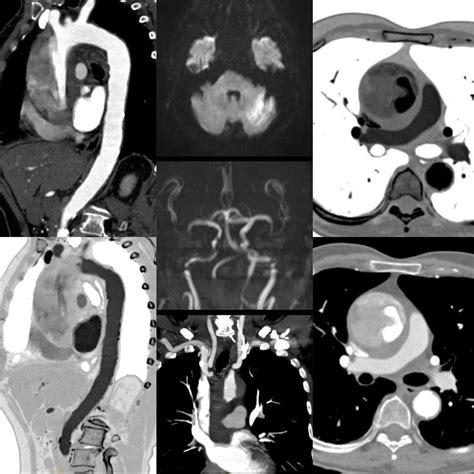 Radiology Ctimaging Arotogram Ctscan Ukradiography Mri Neuroimaging Sridaran Ragul