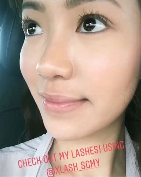 xlash results1 - Xlash Cosmetics Singapore