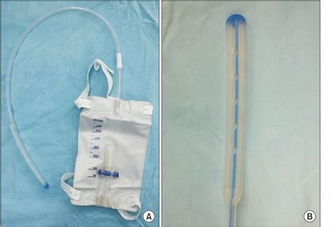 Figure From Comparative Study Between Transanal Tube And Loop Ileostomy In Low Anterior