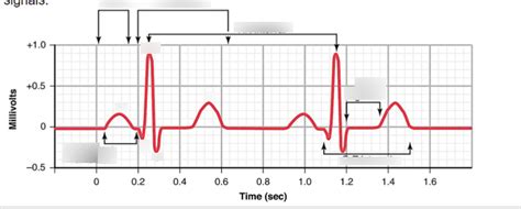 Ecg Diagram Quizlet