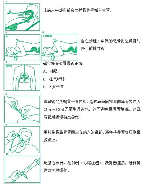 经鼻插胃管 经口插胃管 伤感说说吧