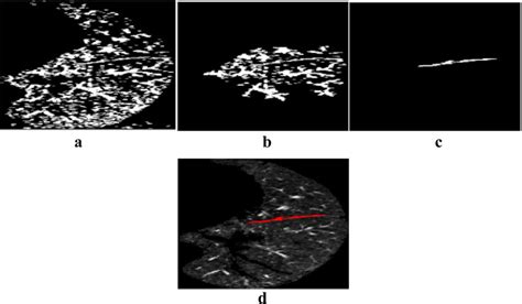 Experimental Results Obtained From Left Lung Fissure Detection Phase Of