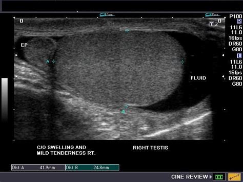 A Gallery Of High Resolution Ultrasound Color Doppler And 3d Images