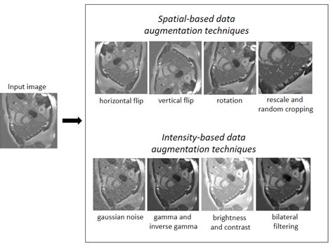Both Spatial And Intensity Based Data Augmentation Techniques Are Download Scientific Diagram