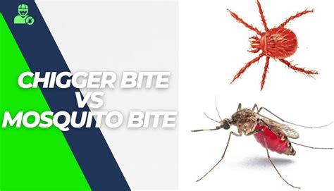 Chigger Bite Vs Mosquito Bite In 5 Important Points Explained Y L P C