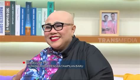 Pengobatan Kanker Pakai Bpjs Nunung Antre Juga Enggak Apa Apa