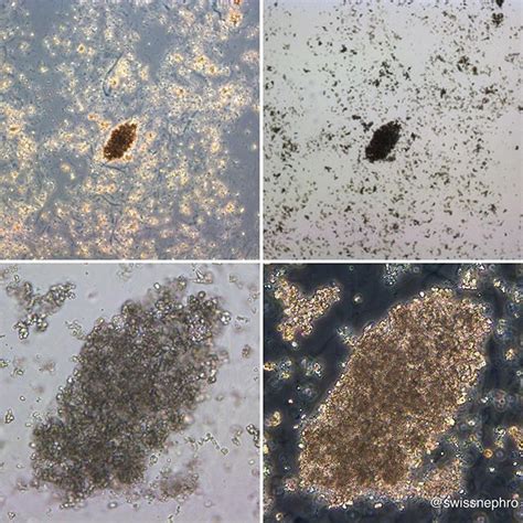 Abundant Amorphous Phosphate With A Pseudocast Phase Contrast Bright Field Original