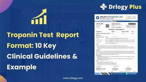 Key Clinical Guidelines For Troponin Test Report Format Drlogy