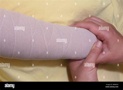 Lymphedema Management Wrapping Lymphedema Hand And Arm Using